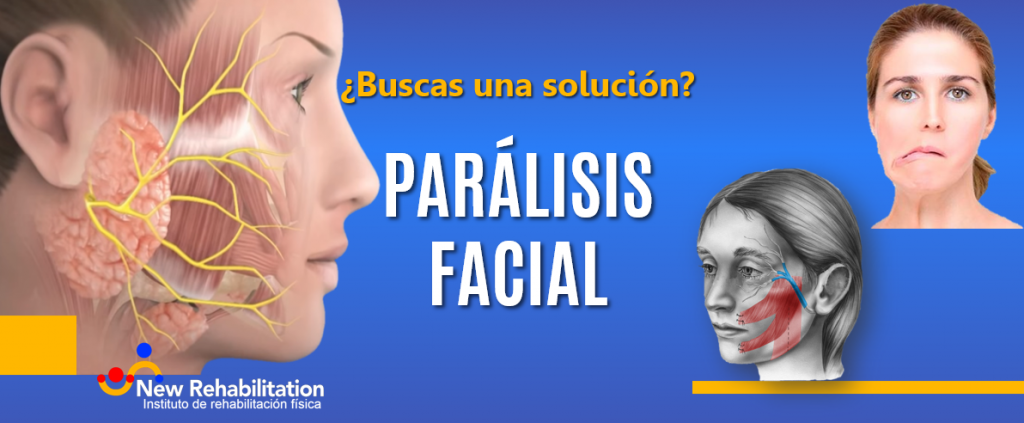 Parálisis facial, sus diferentes tipos y cómo recuperarte ...