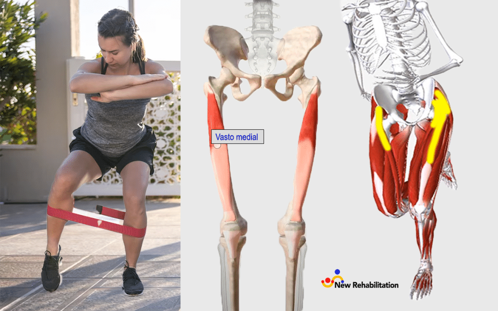 Vasto medial: el músculo olvidado en el deporte y cómo tratar su lesión
